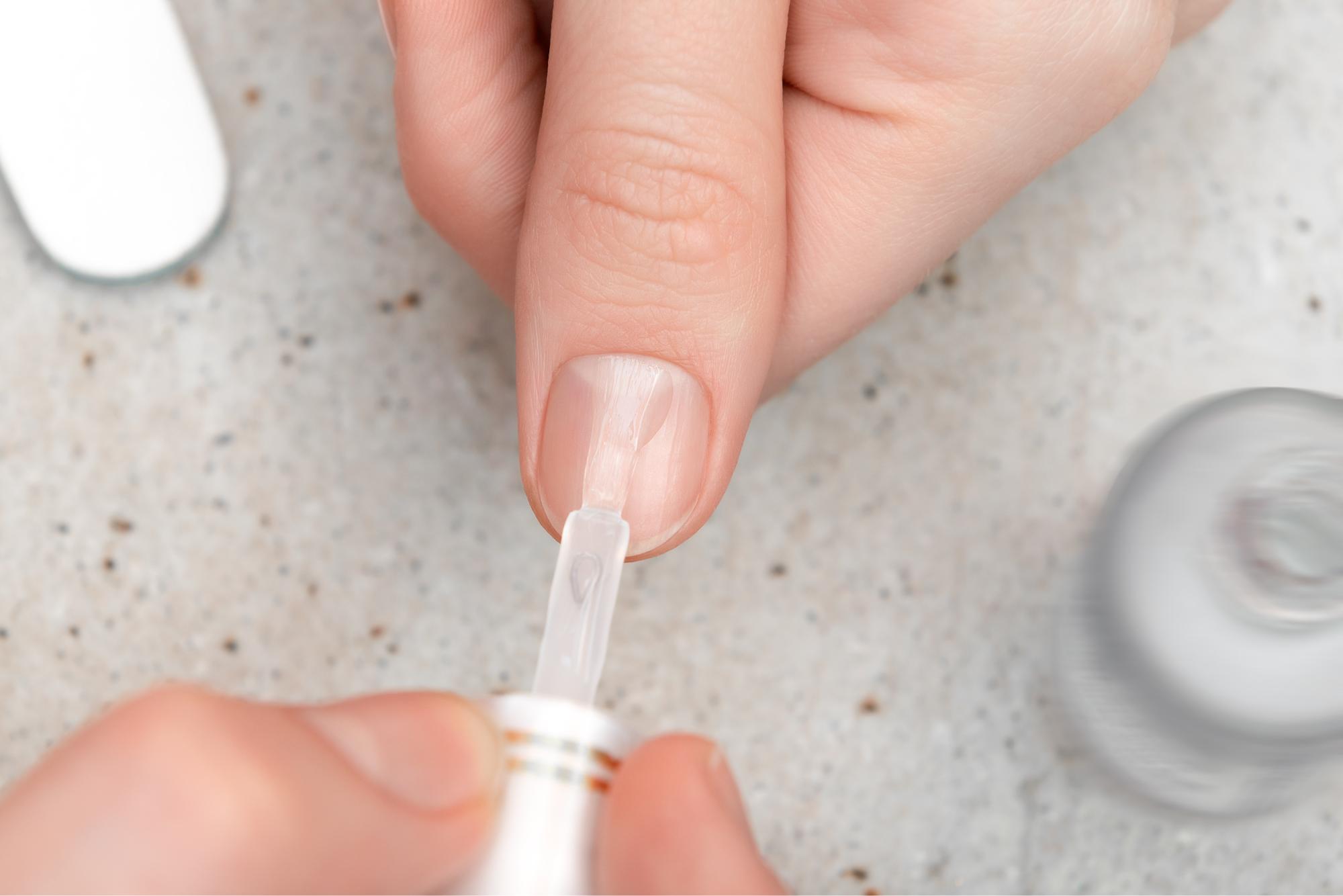 How to Remove Yellow Stains from Nails : Remedies and Prevention Tips